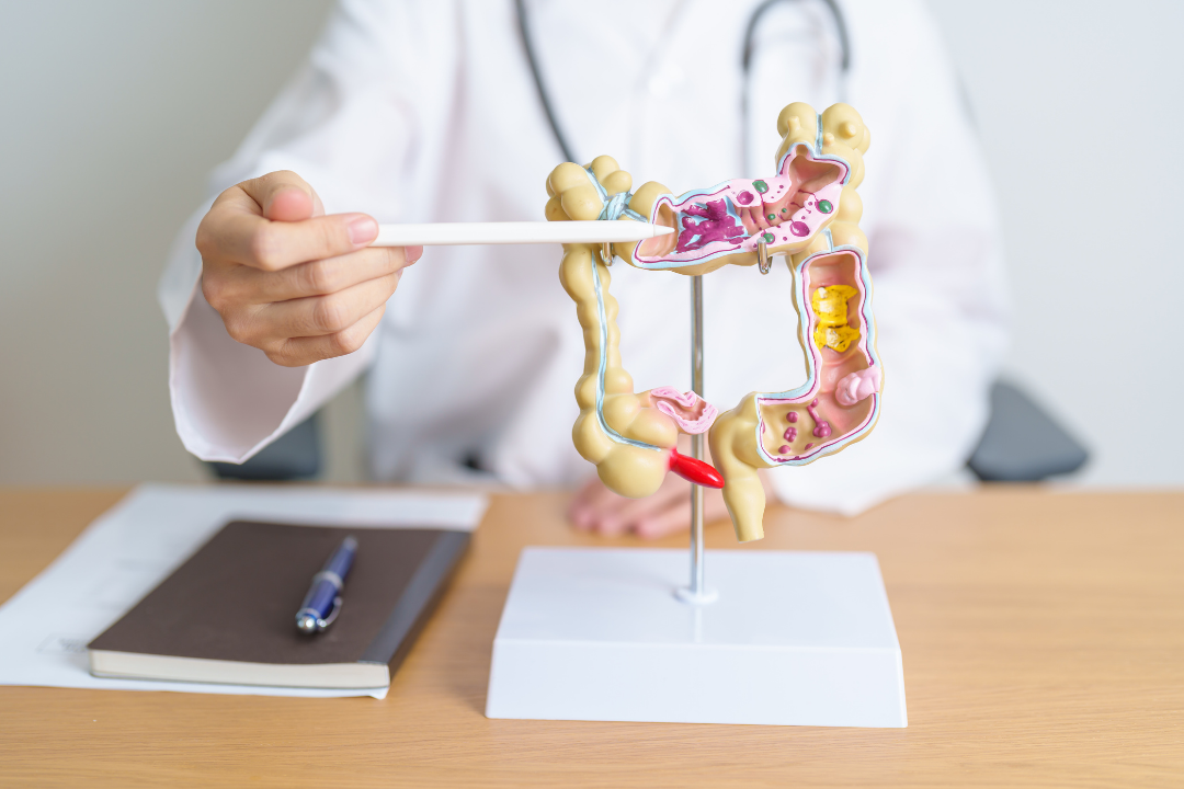 Colorectal Cancer Surgery: Types, Recovery, and What to Know